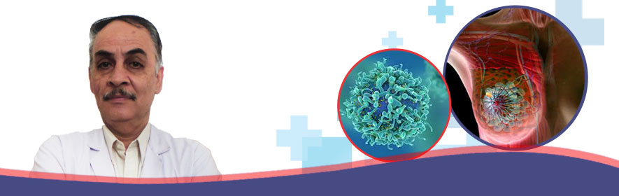 Best Cancer Treatment | Best Cancer Hospital in Greater Noida